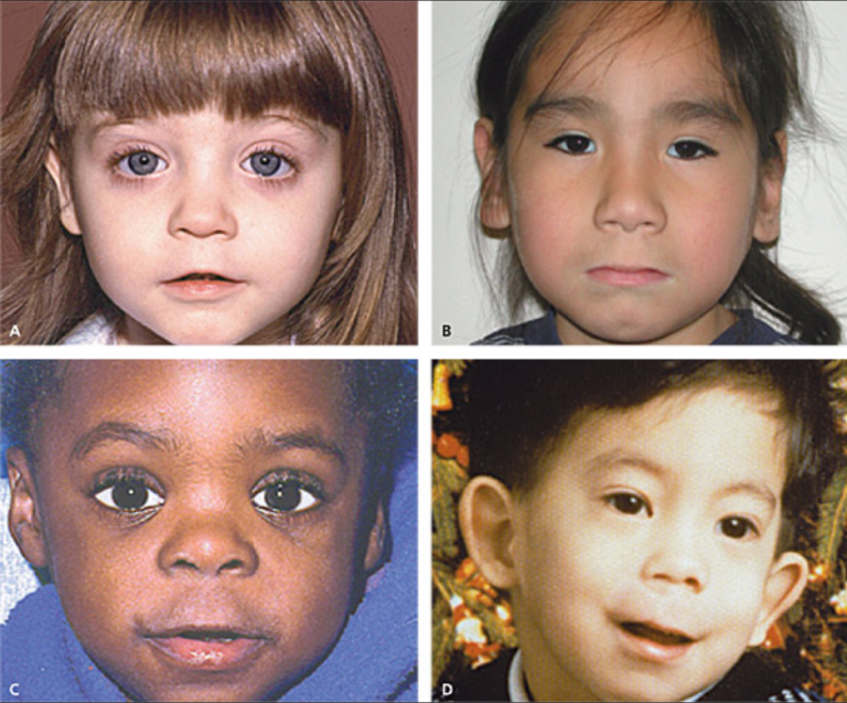 What is FASD? – Let's Get Real Alberta